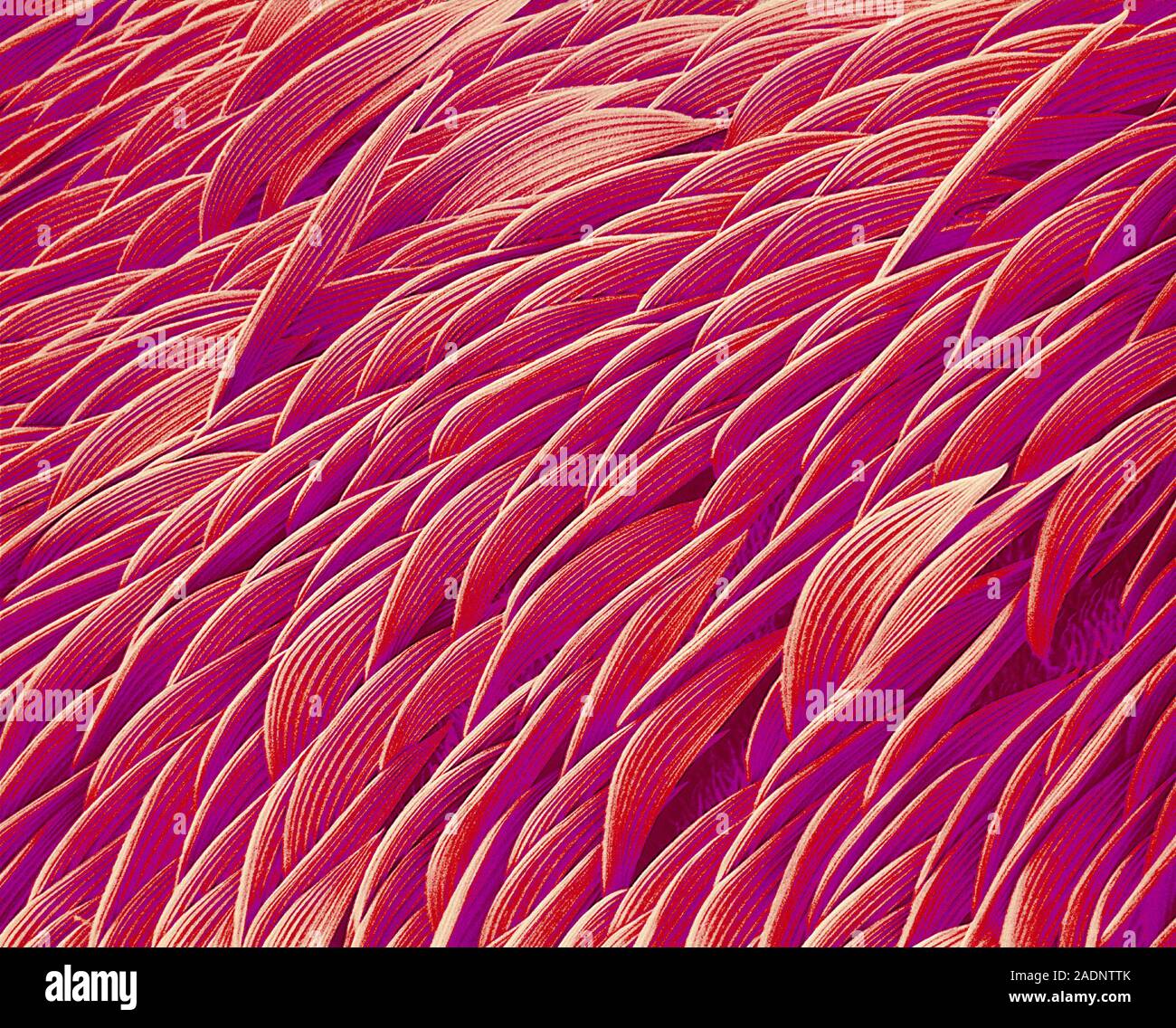 Mosquito body surface. Coloured scanning electron micrograph (SEM) of ...