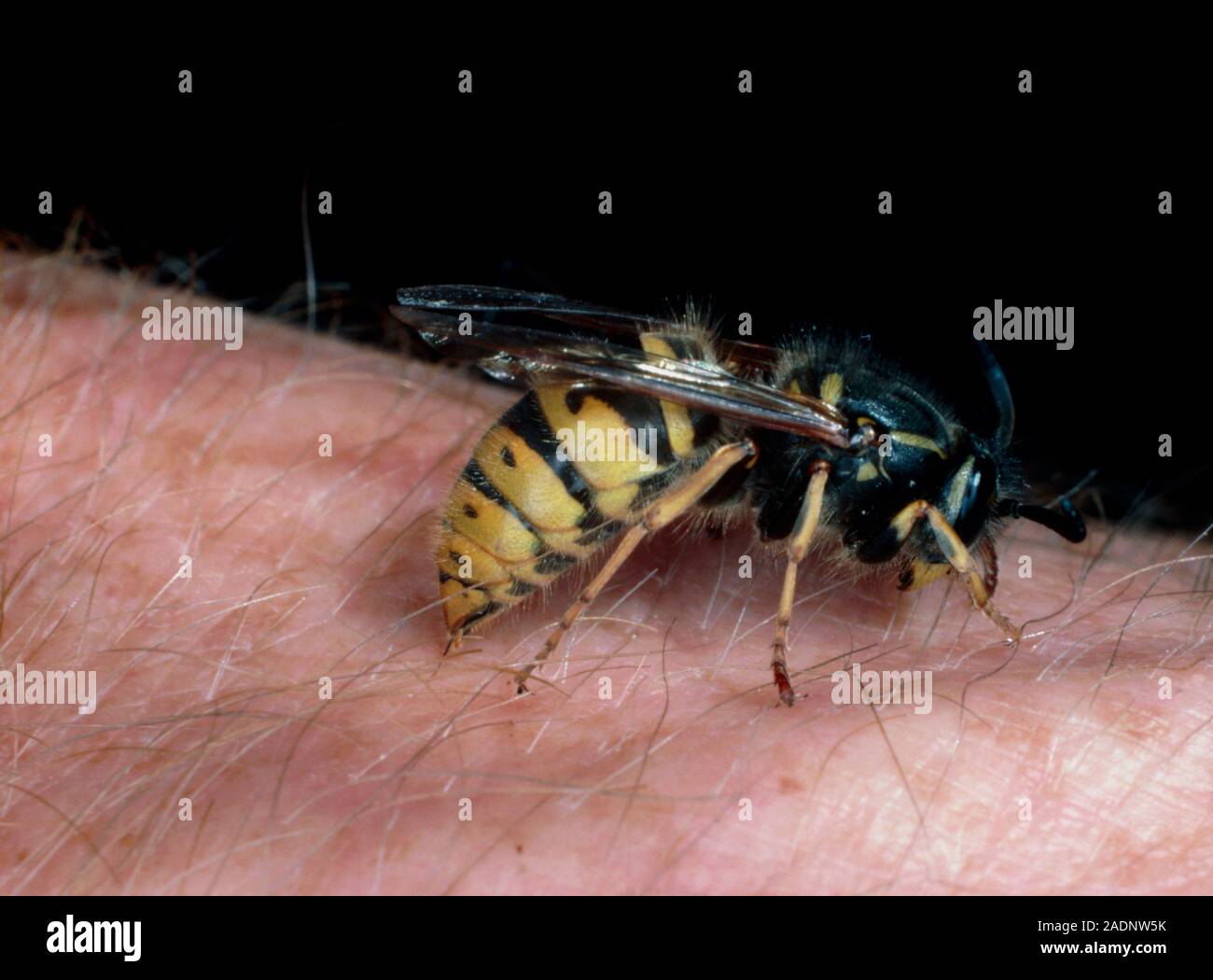 The common wasp (Vespula vulgaris) in the act of stinging. The sting ...