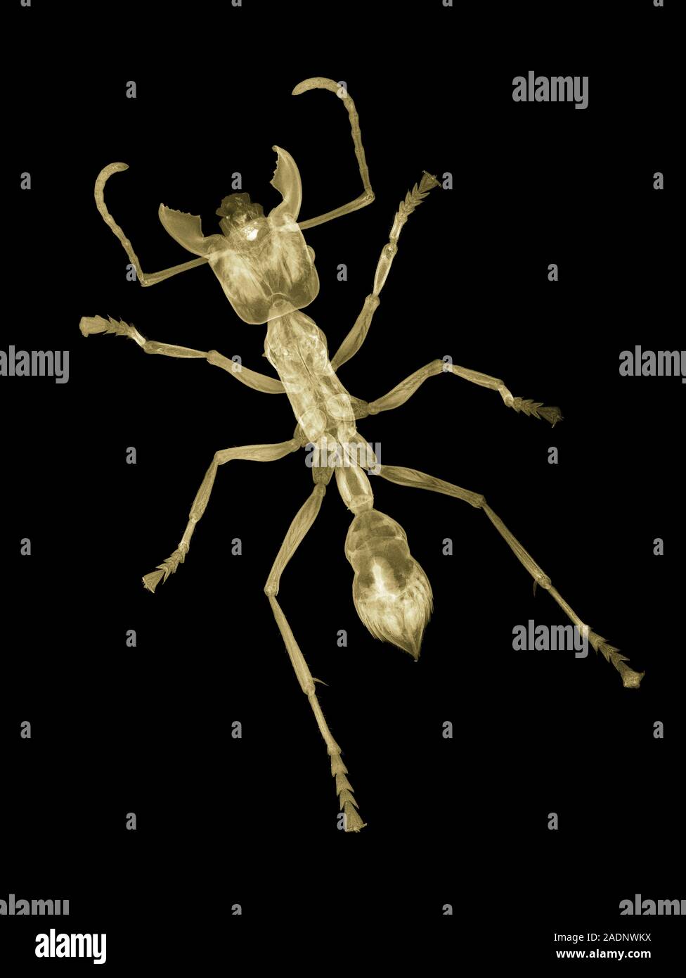 Ant, negative X-ray. The jaws and antennae are located on its head (top ...