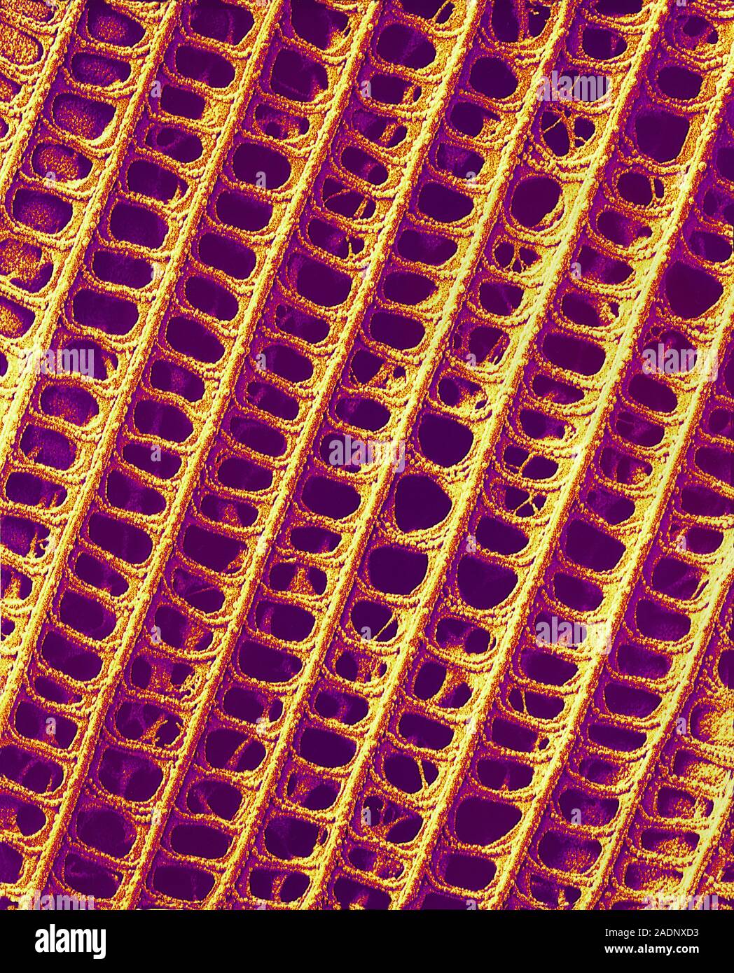 Butterfly wing. Image 6 of 6. Coloured scanning electron micrograph ...
