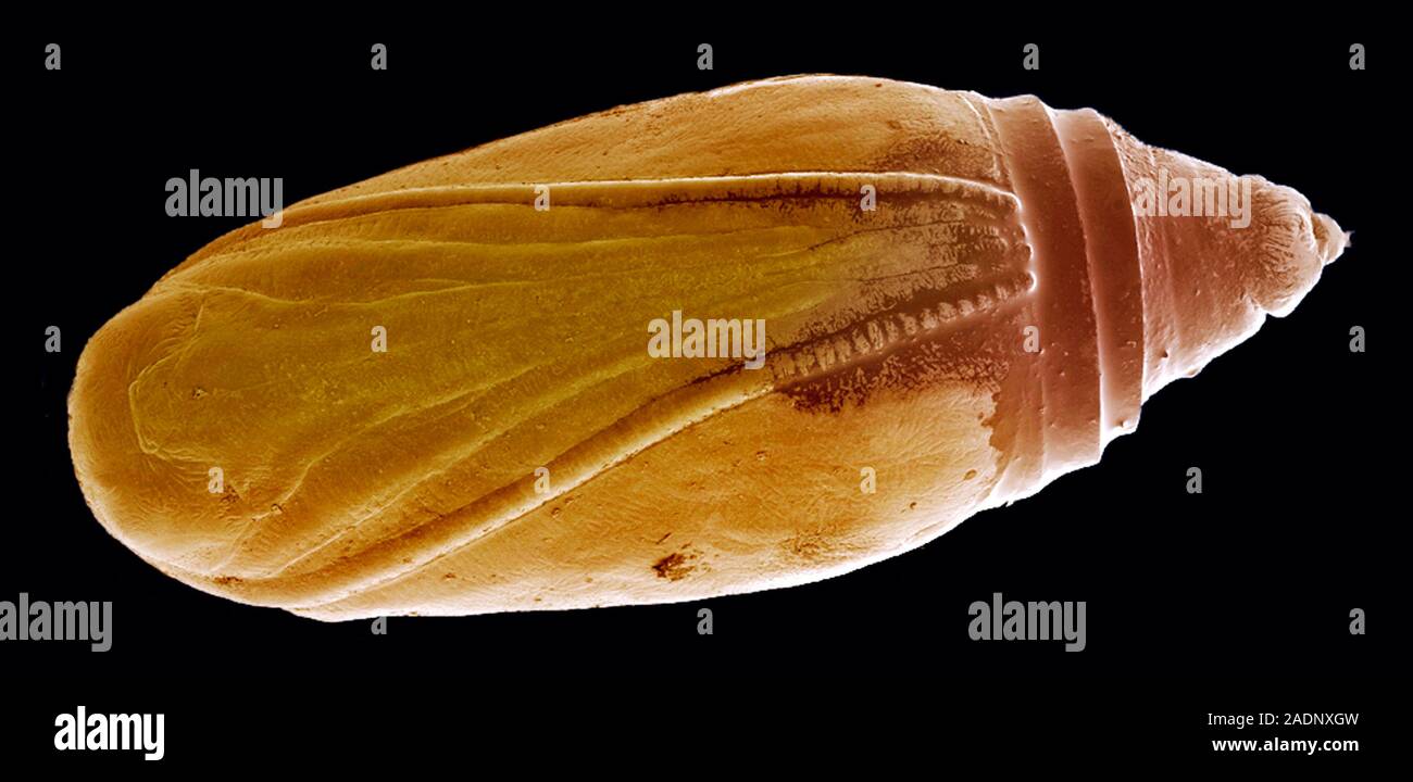 Pupa. Coloured scanning electron micrograph (SEM) of a Lepidopteran ...