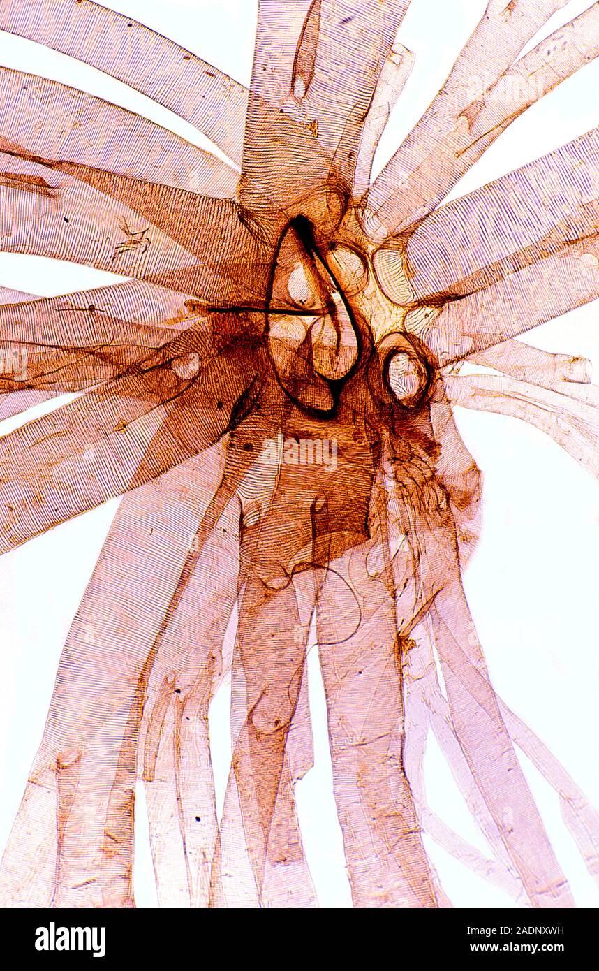 Silk moth caterpillar air pore. Polarised light micrograph of a ...