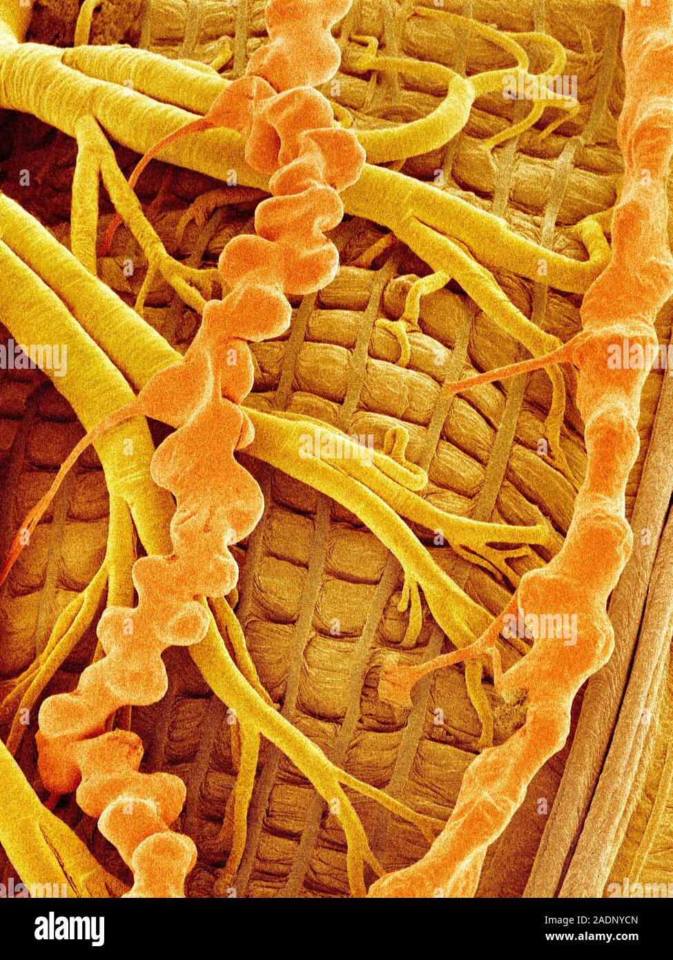 Moth's interior. Coloured scanning electron micrograph (SEM) of the ...