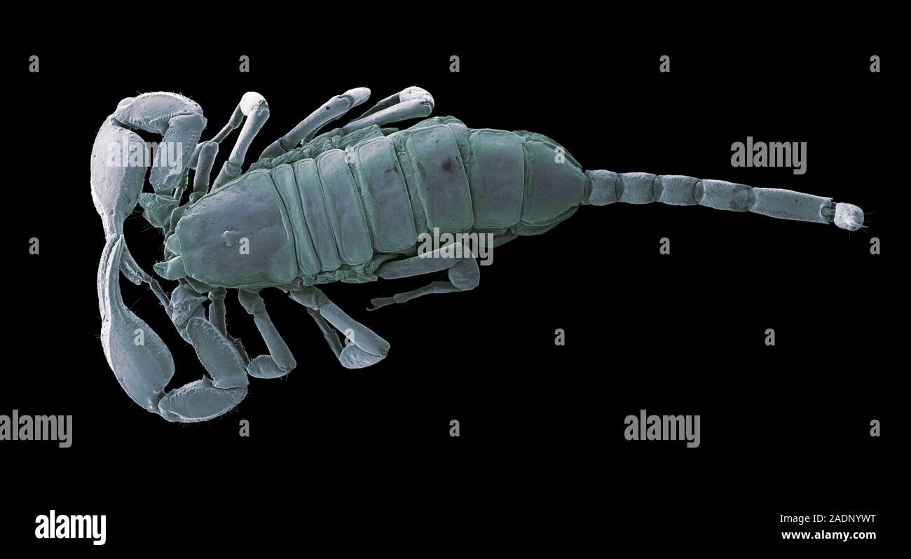 European scorpion. Coloured scanning electron micrograph (SEM) of a ...