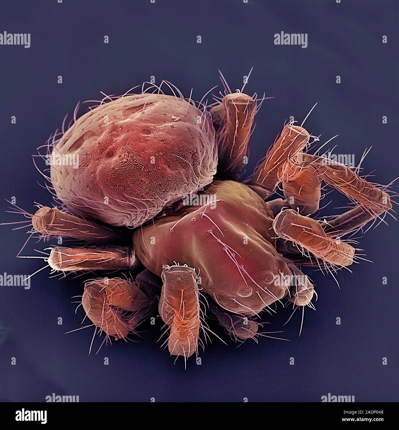 Spider. Coloured scanning electron micrograph (SEM) of an unidentified ...