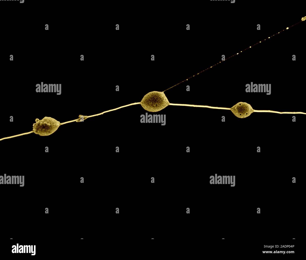 Spider's web. Coloured environmental scanning electron micrograph (ESEM ...