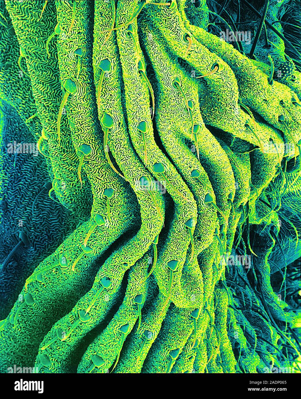 Spider's body surface. Coloured scanning electron micrograph (SEM) of ...