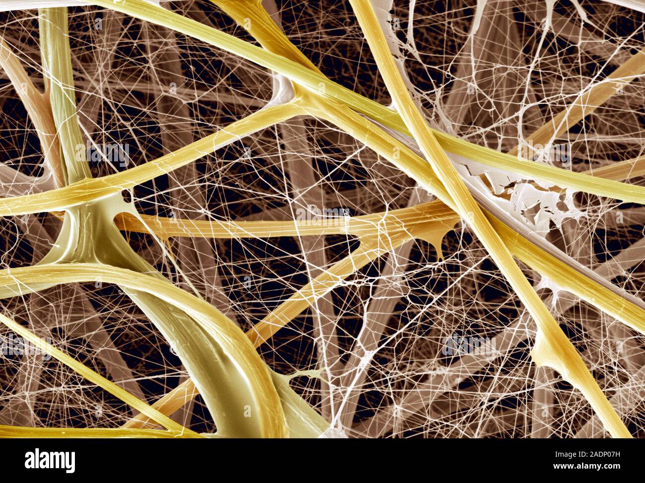 Spider's web. Coloured scanning electron micrograph (SEM) of threads of ...