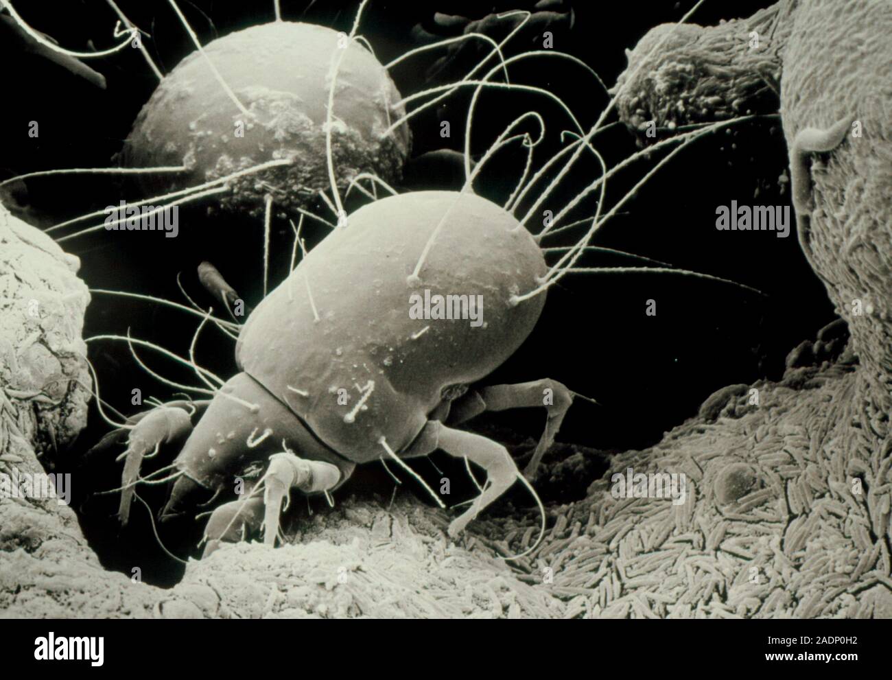 Scanning electron micrograph of the soft-bodied mite Acarus siro (or ...