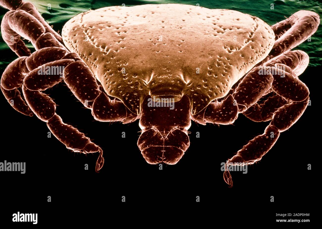 SEM (scanning electron micrograph) of the brown dog tick, Rhipicephalus ...