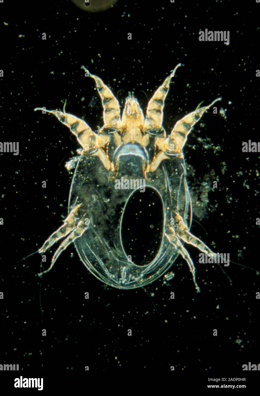 Light micrograph of the parasitic mite Psoroptes ovis, the cause of the ...