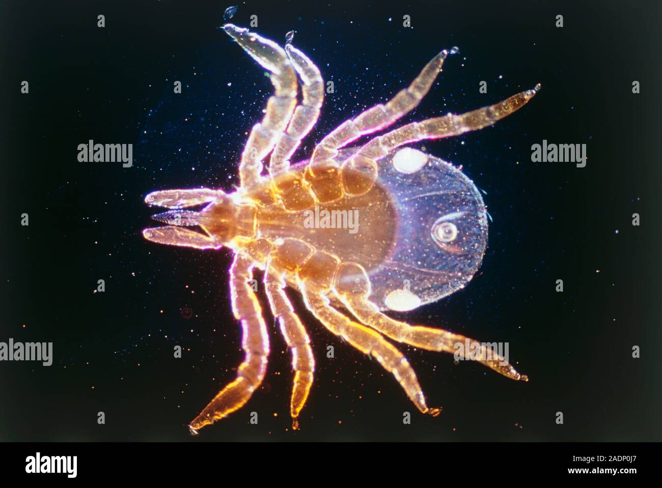 Light micrograph of the tick, Ixodes sp., that transmits Lyme disease ...