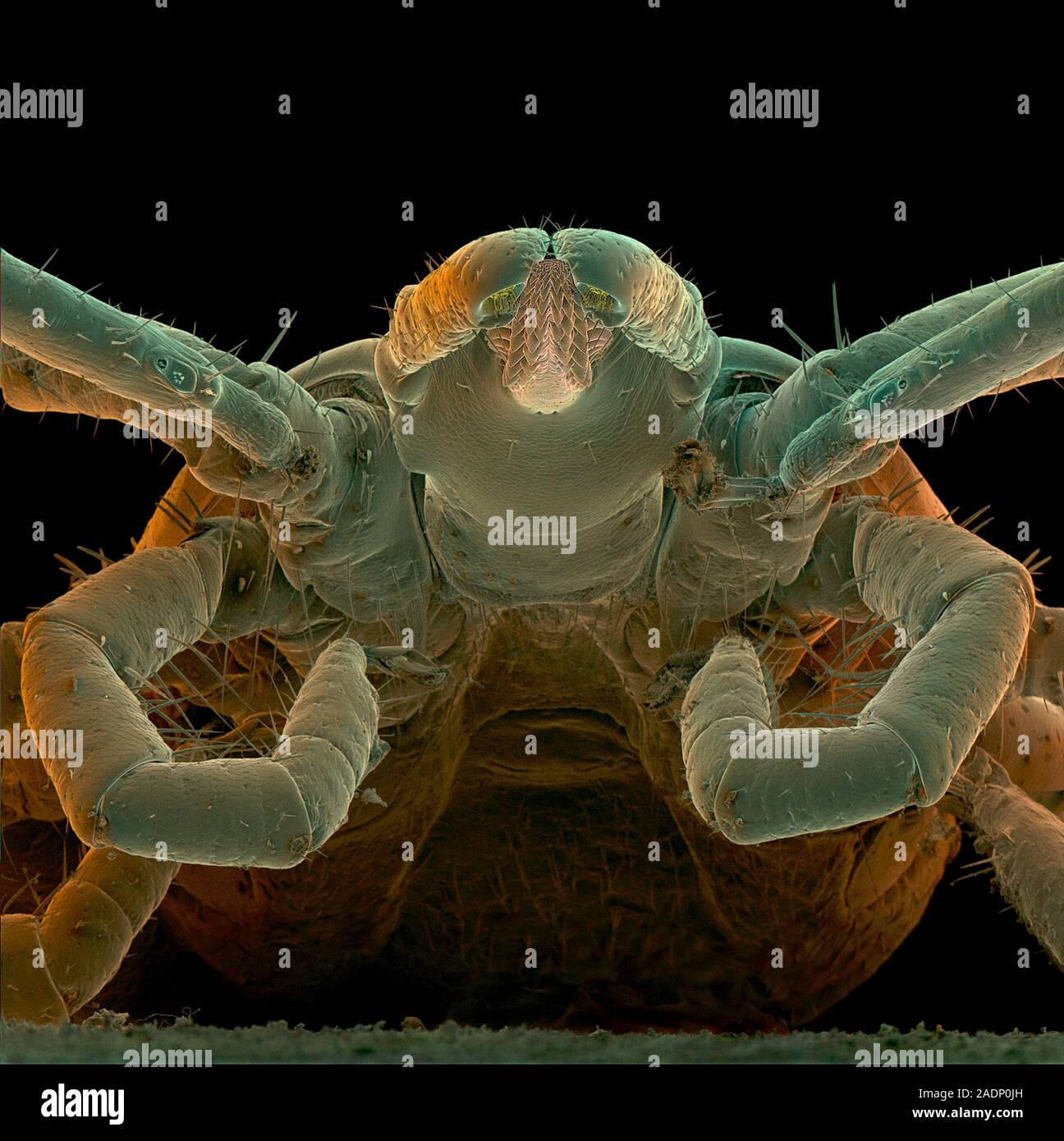 Deer tick. Scanning electron micrograph (SEM) of a deer tick Ixodes sp ...