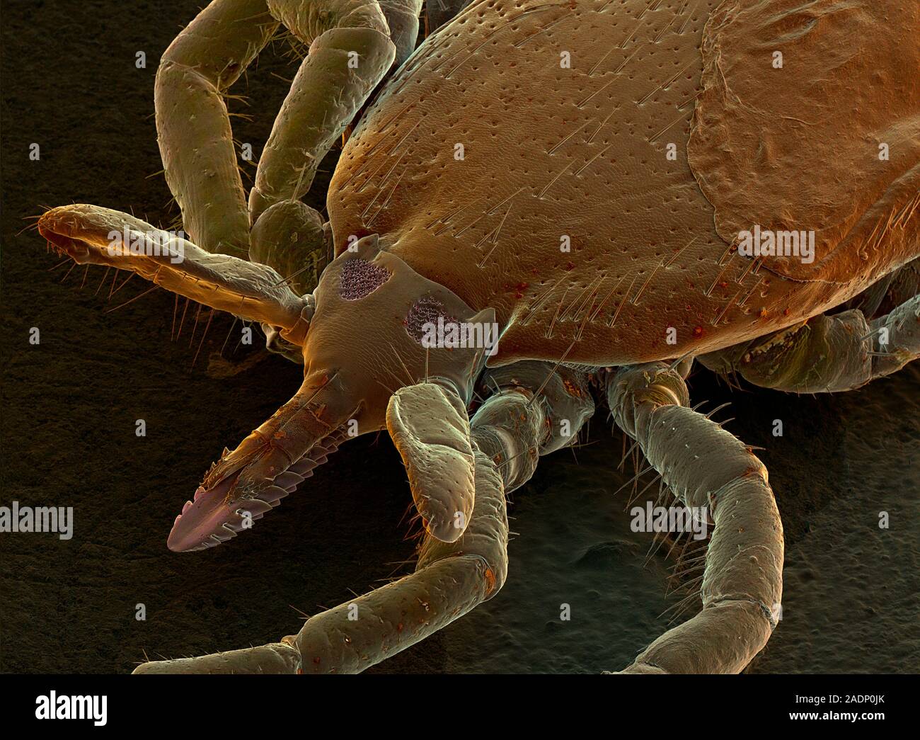 Deer tick. Coloured Scanning Electron Micrograph (SEM) of the deer tick ...