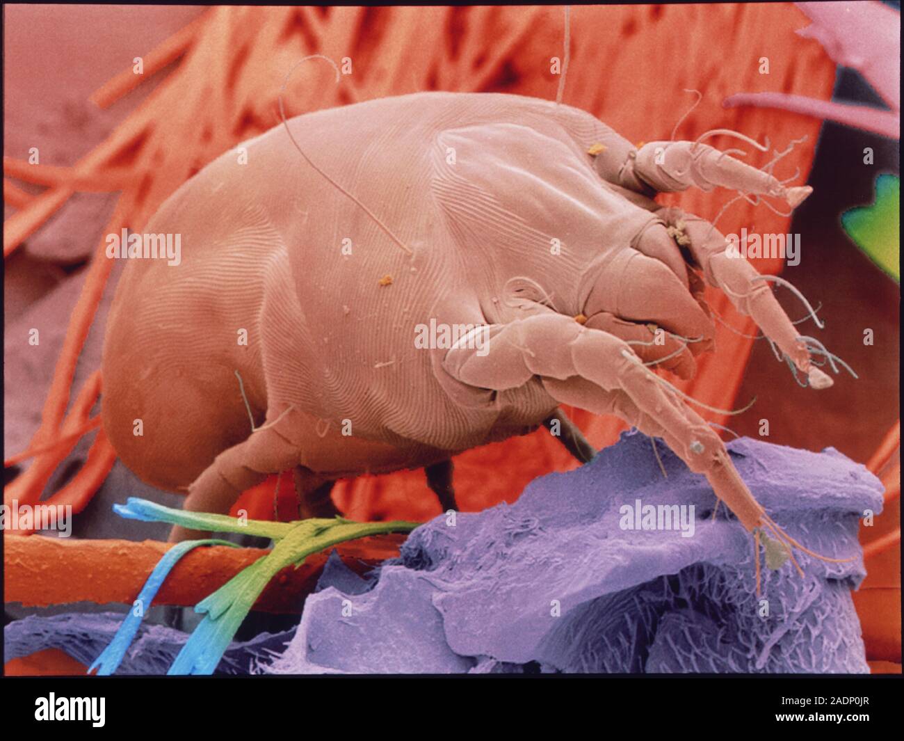 Dust mite. Coloured Scanning Electron Micrograph (SEM) of a dust mite ...