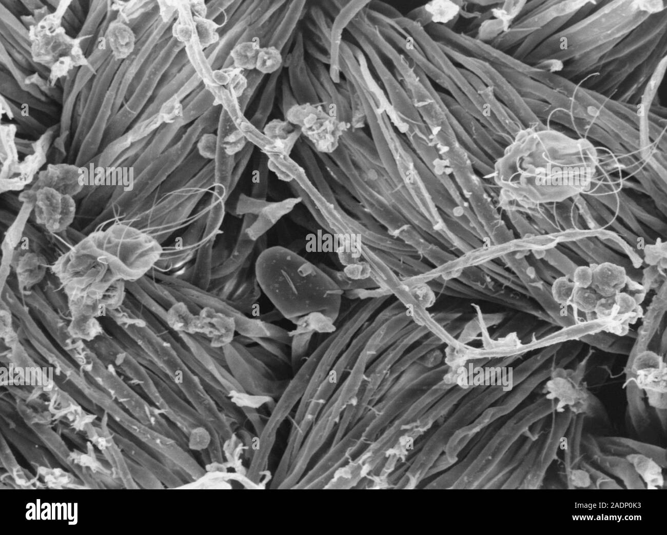 Dust mite remains. Scanning electron micrograph of dust mite body ...