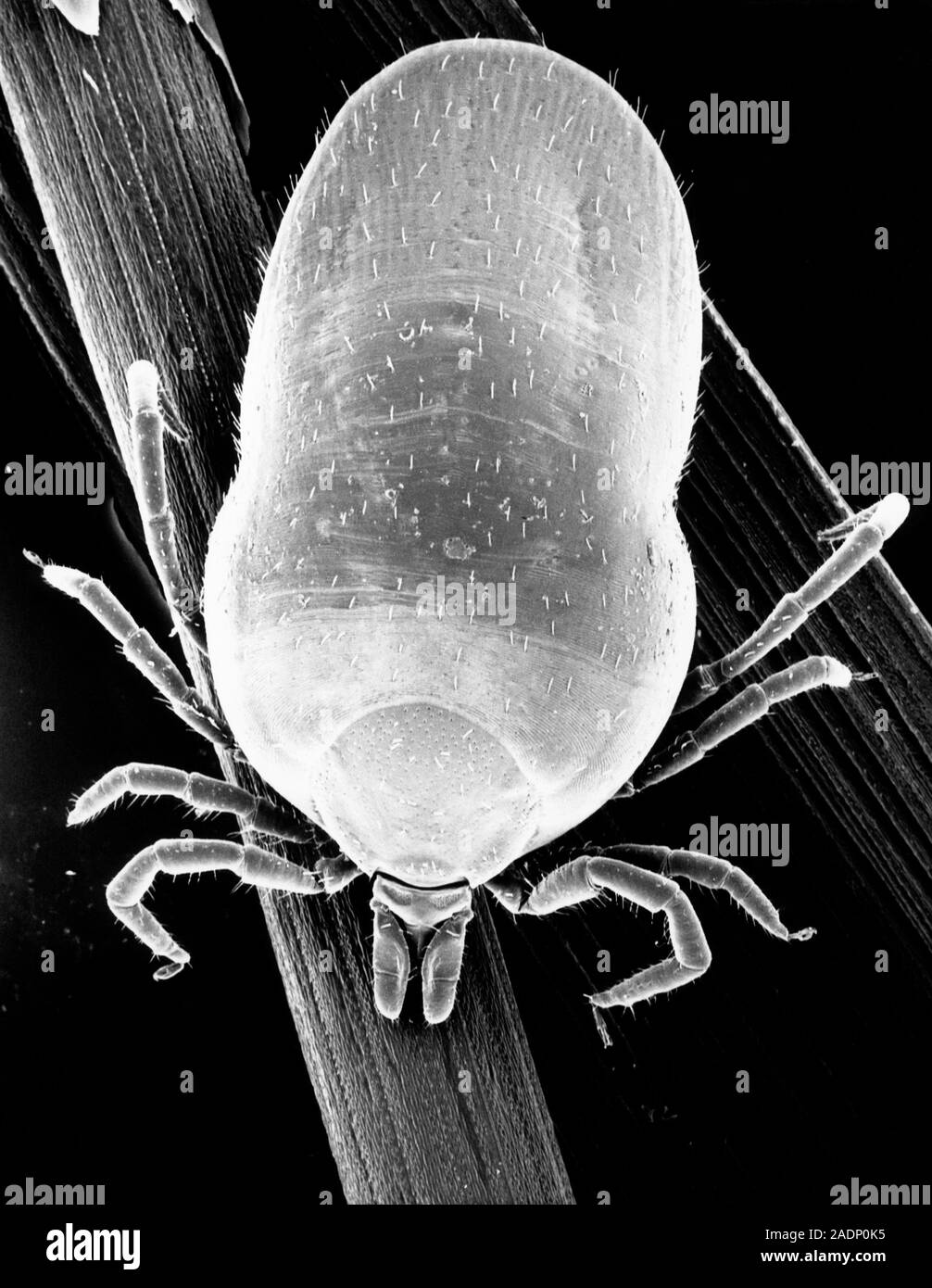 Lyme disease tick. Scanning electron micrograph of an engorged female ...