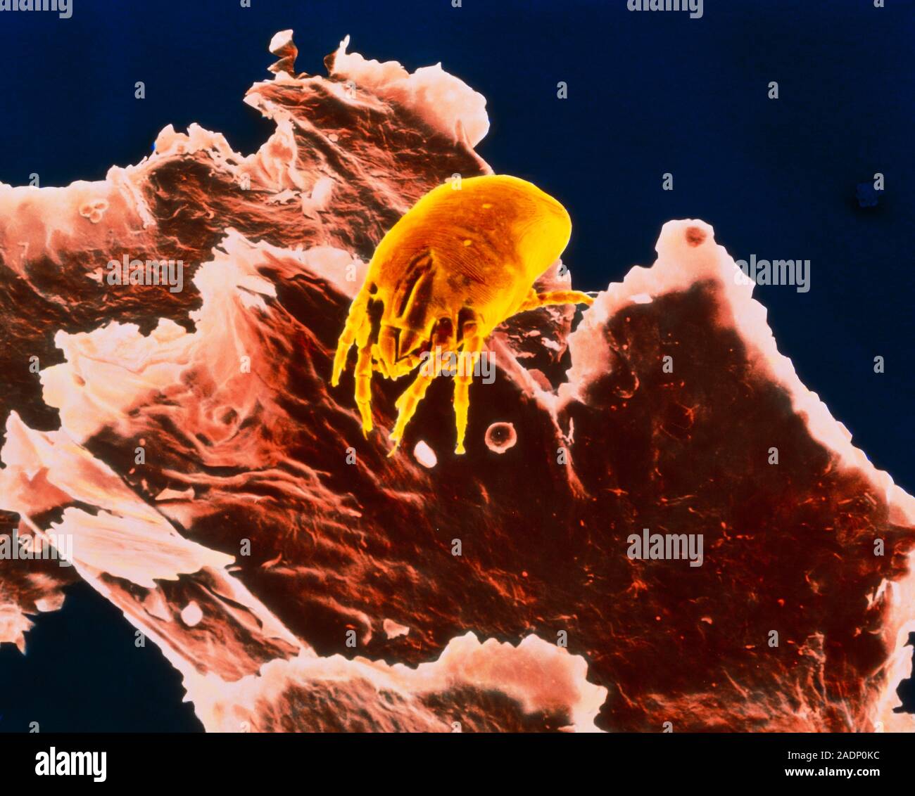 Dust mite. Coloured scanning electron micrograph of a dust mite ...