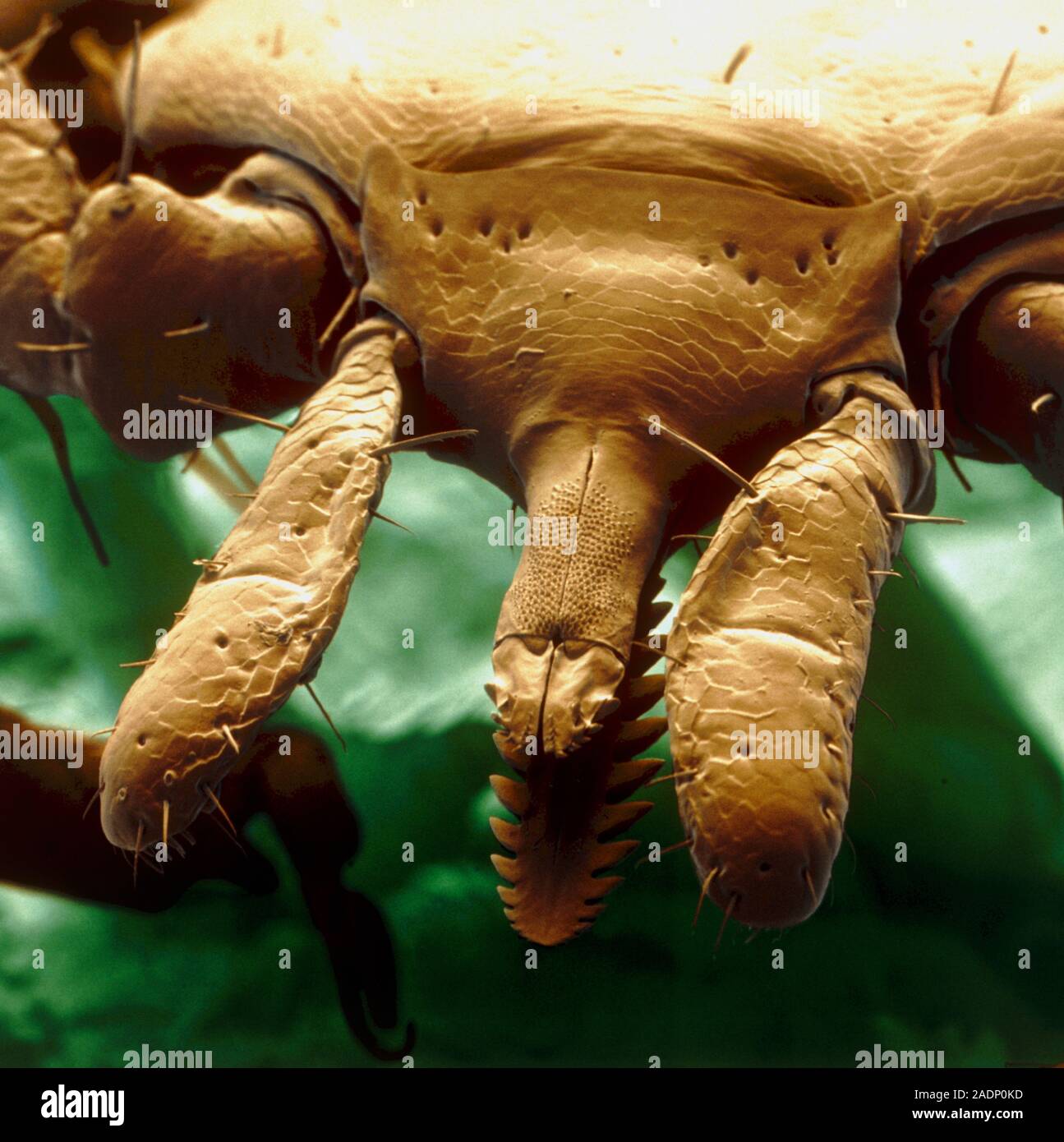 Sheep tick mouthparts. Coloured scanning electron micrograph (SEM) of ...