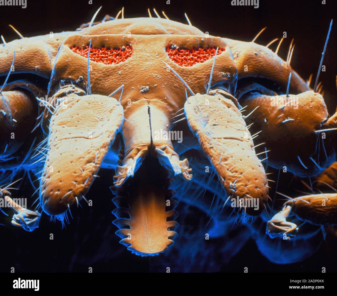 Lyme disease tick mouthparts. Coloured Scanning Electron Micrograph ...