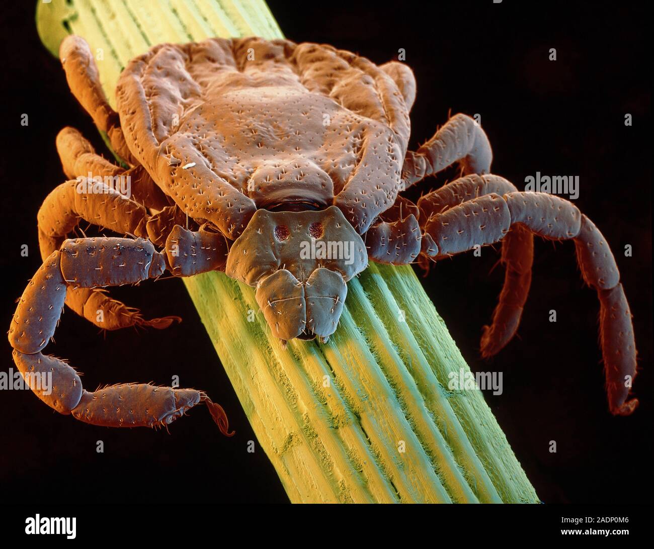 Dog tick. Coloured scanning electron micrograph (SEM) of a brown dog ...