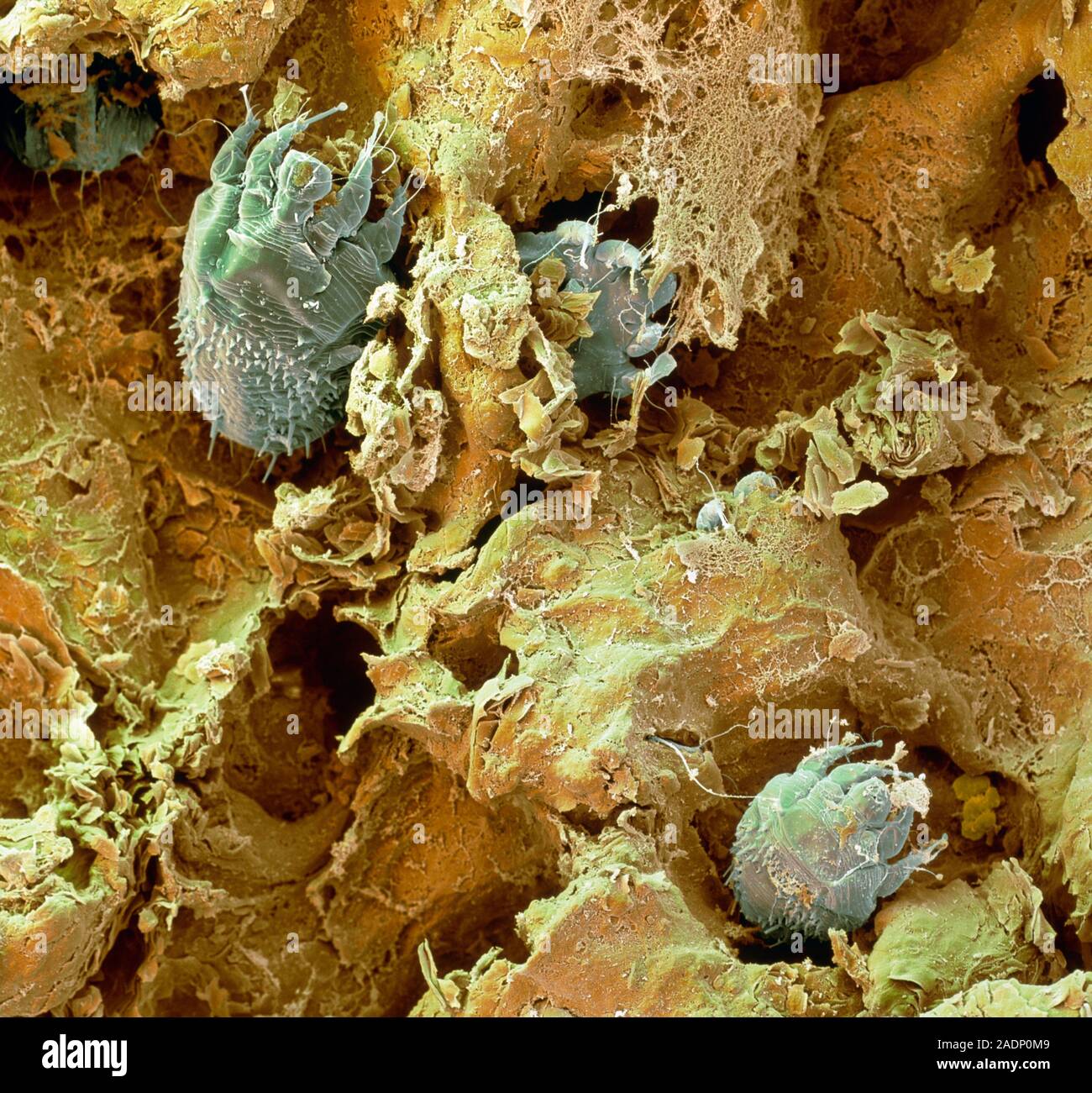 Itch mites. Coloured scanning electron micrograph (SEM) of itch mites ...
