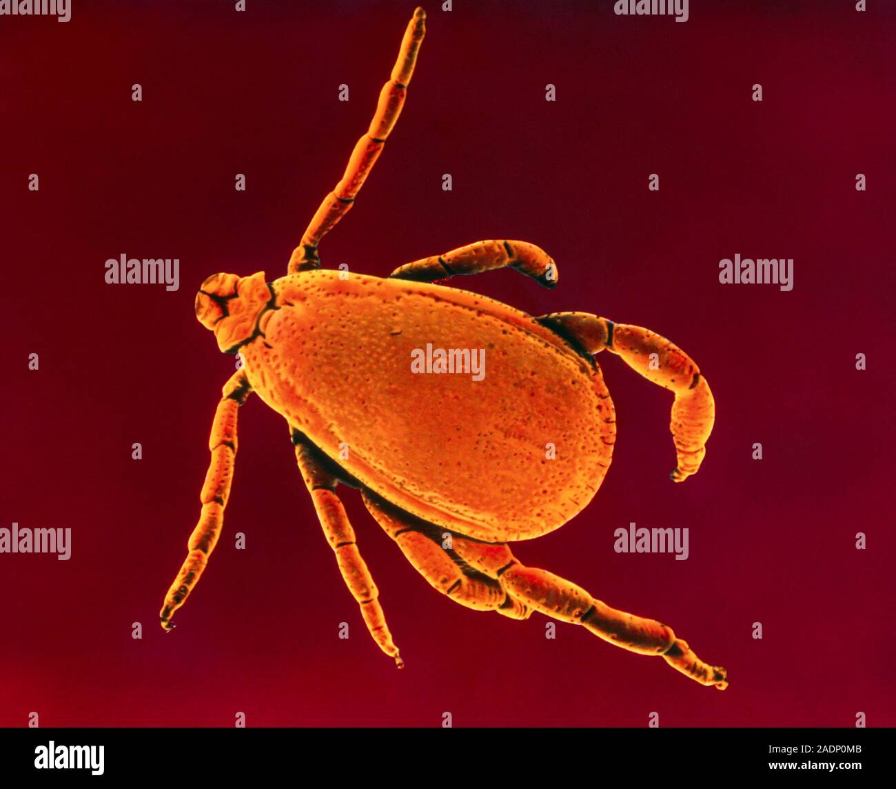 Dog tick. Coloured scanning electron micrograph of a male brown dog ...
