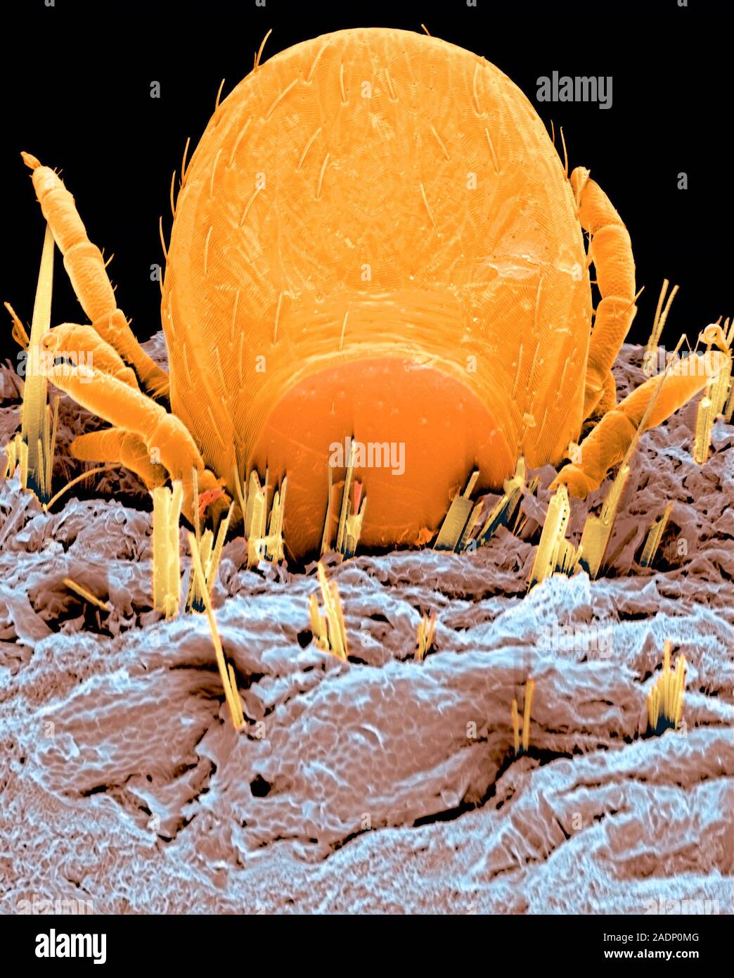 Feeding tick. Coloured scanning electron micrograph (SEM) of a tick ...