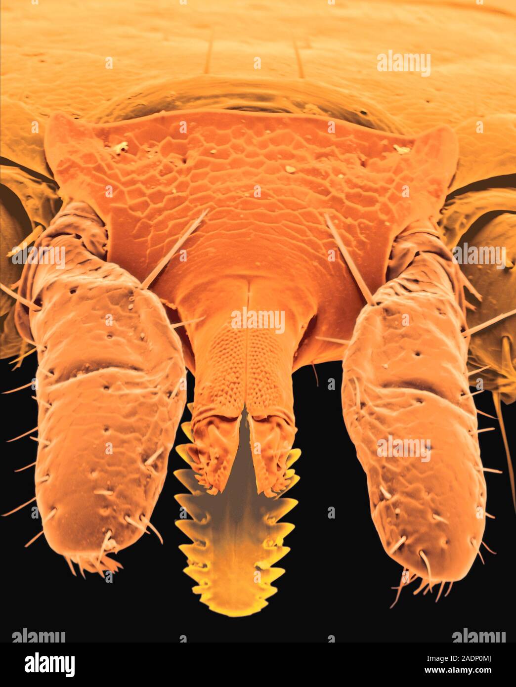 Lyme disease tick. Coloured scanning electron micrograph (SEM) of the ...