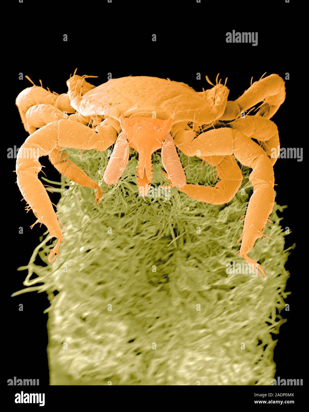 Lyme disease tick. Coloured scanning electron micrograph (SEM) of a ... Lyme disease tick. Coloured scanning electron micrograph (SEM) of a ...