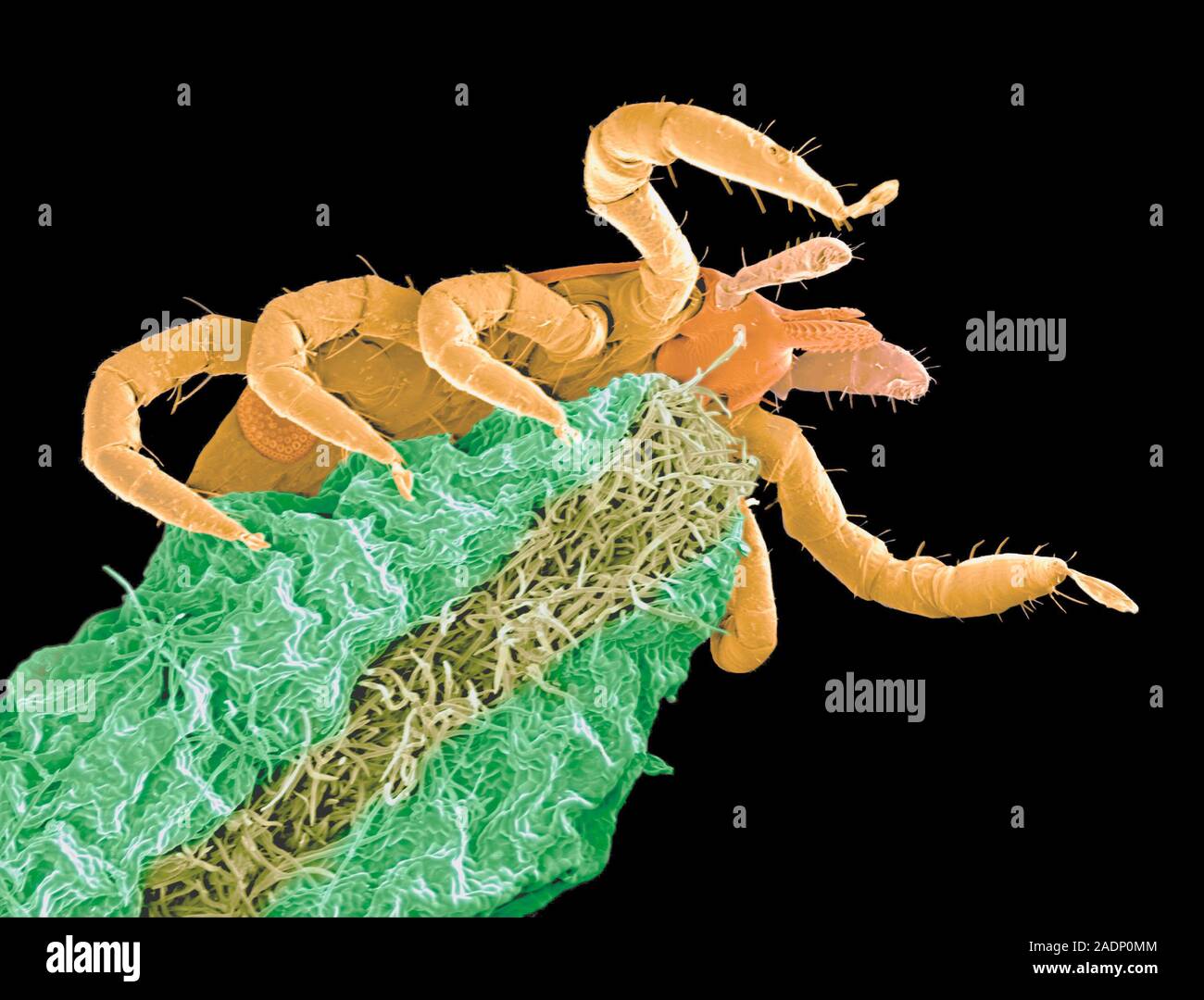 Lyme disease tick. Coloured scanning electron micrograph (SEM) of a ...