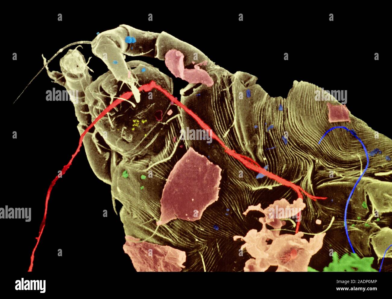 Dust mite. Coloured scanning electron micrograph (SEM) of the head of a ...