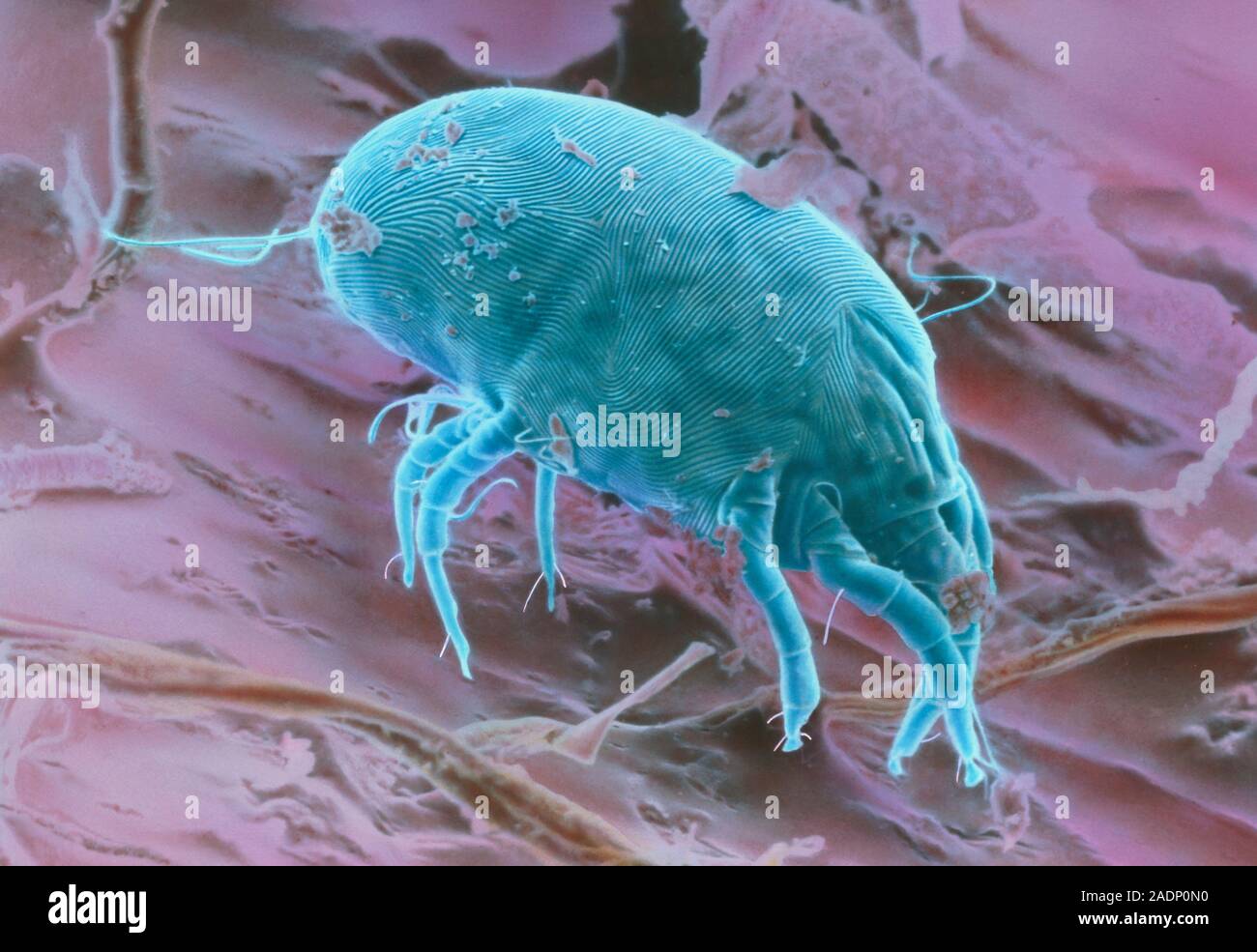 Dust mite. Scanning electron micrograph (SEM) of a dust mite ...