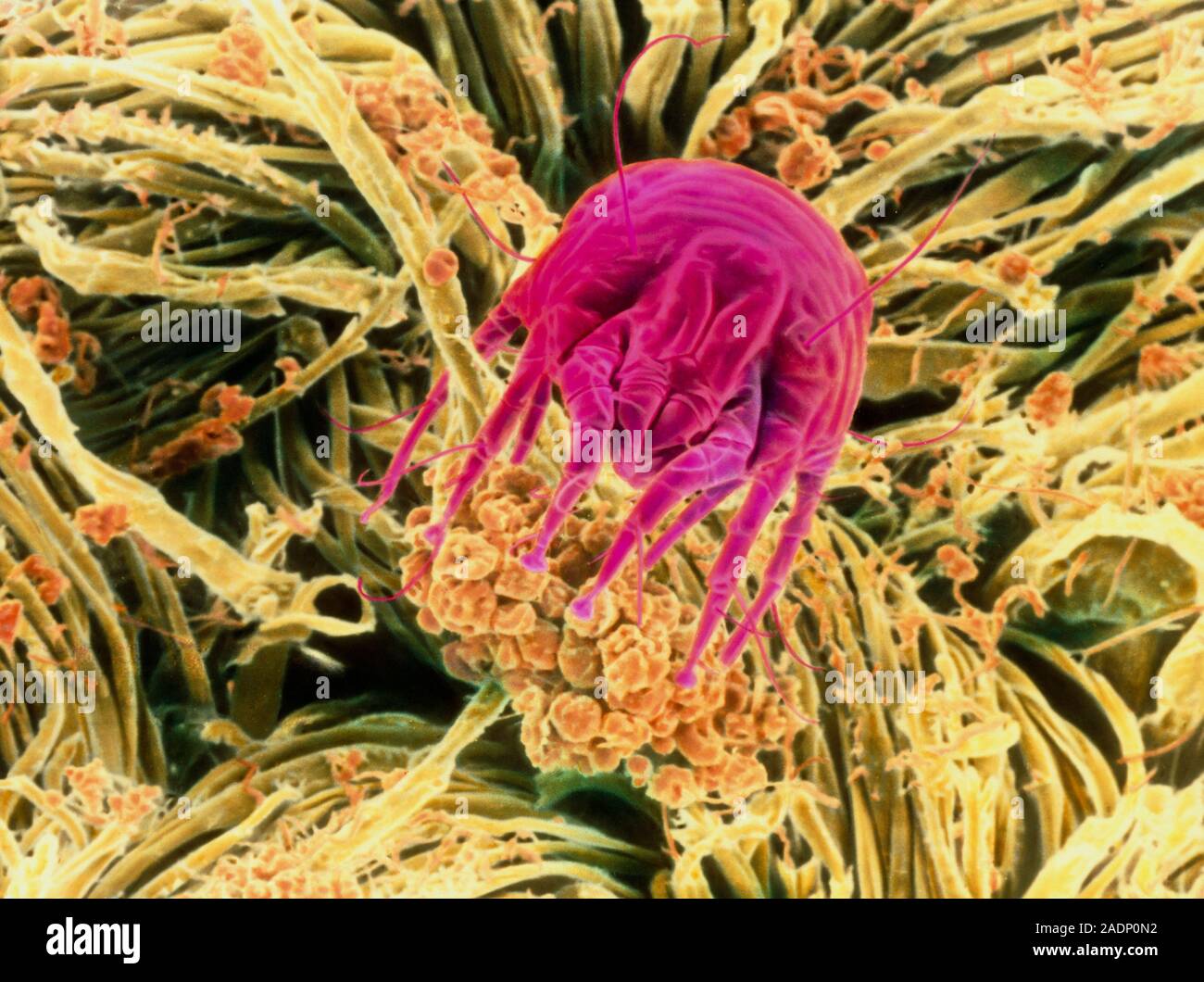 Dust mite. Coloured scanning electron micrograph (SEM) of a dust mite ...