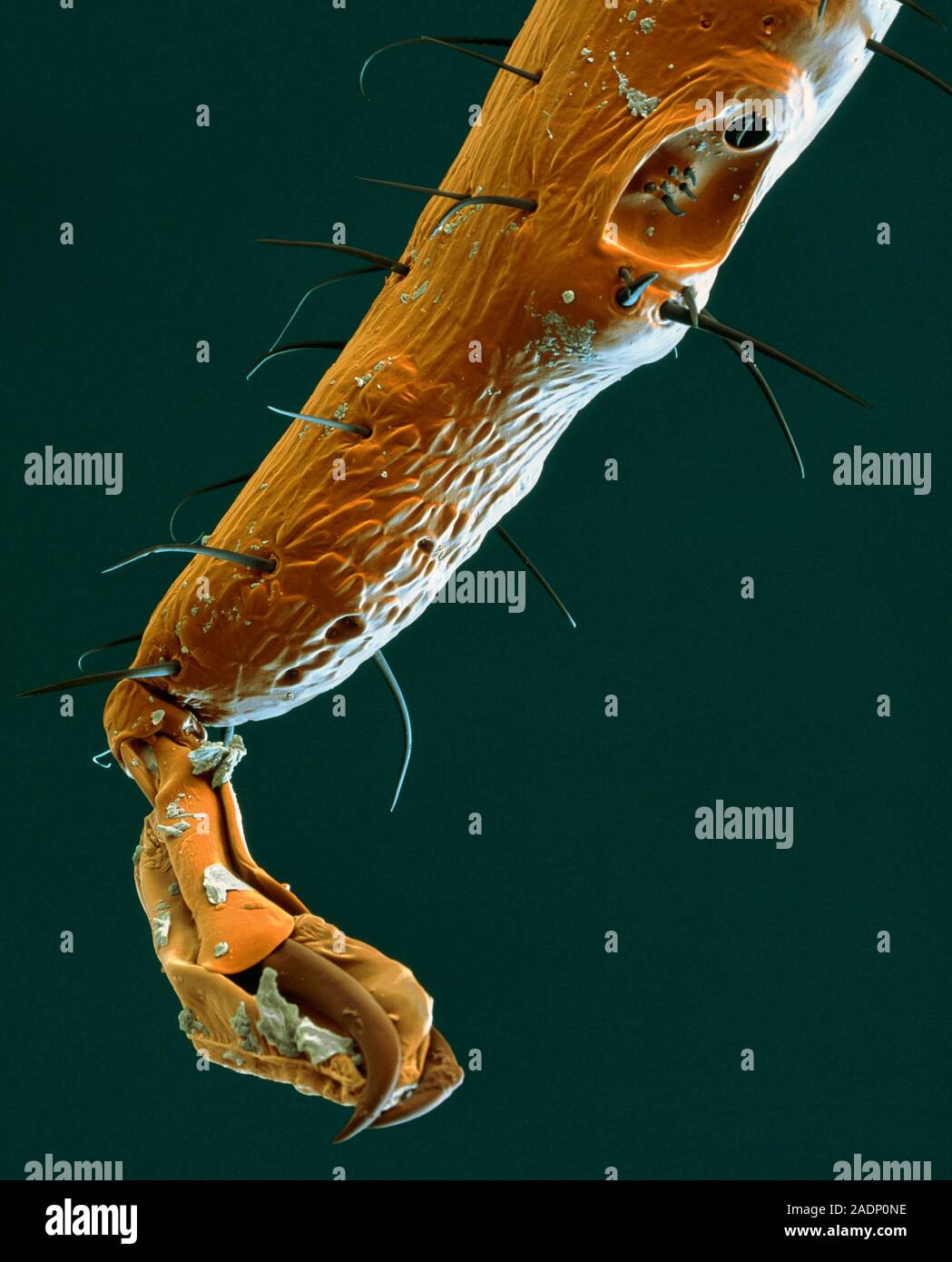Tick leg. Coloured scanning electron micrograph (SEM) of the front leg ...