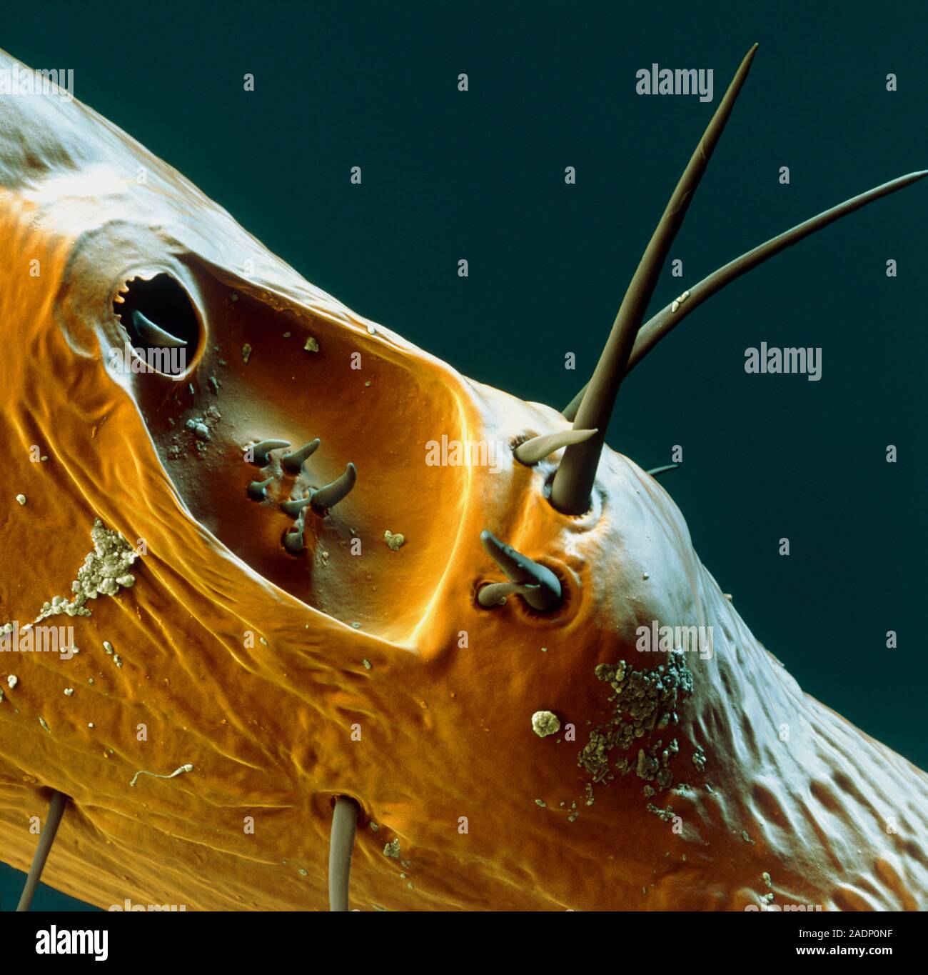Tick leg. Coloured scanning electron micrograph (SEM) of a Haller organ ...