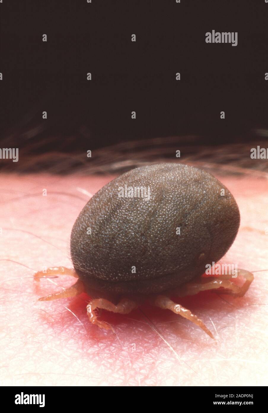 Relapsing fever tick. Macrophotograph of a relapsing fever tick ...