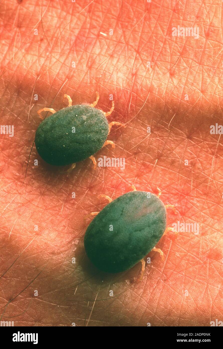 Relapsing fever ticks. Macrophotograph of two relapsing fever ticks ...