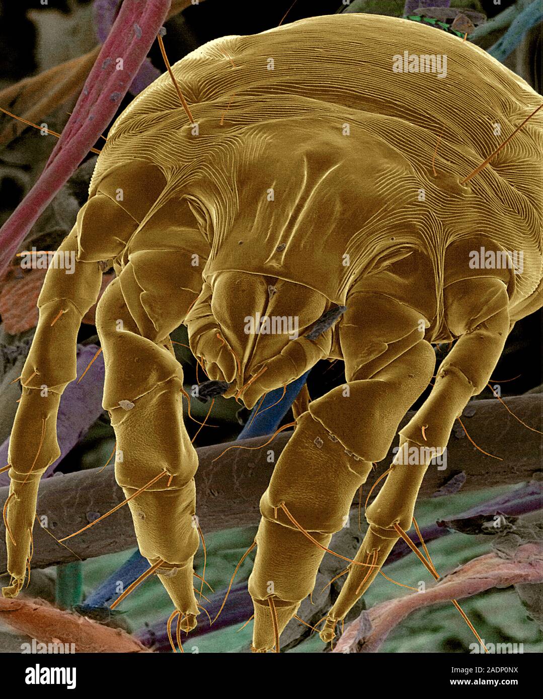 Dust mite. Coloured scanning electron micrograph (SEM) of a dust mite ...