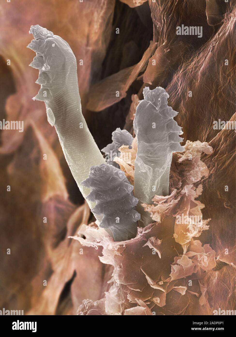 Eyelash mites. Coloured scanning electron micrograph (SEM) of eyelash ...