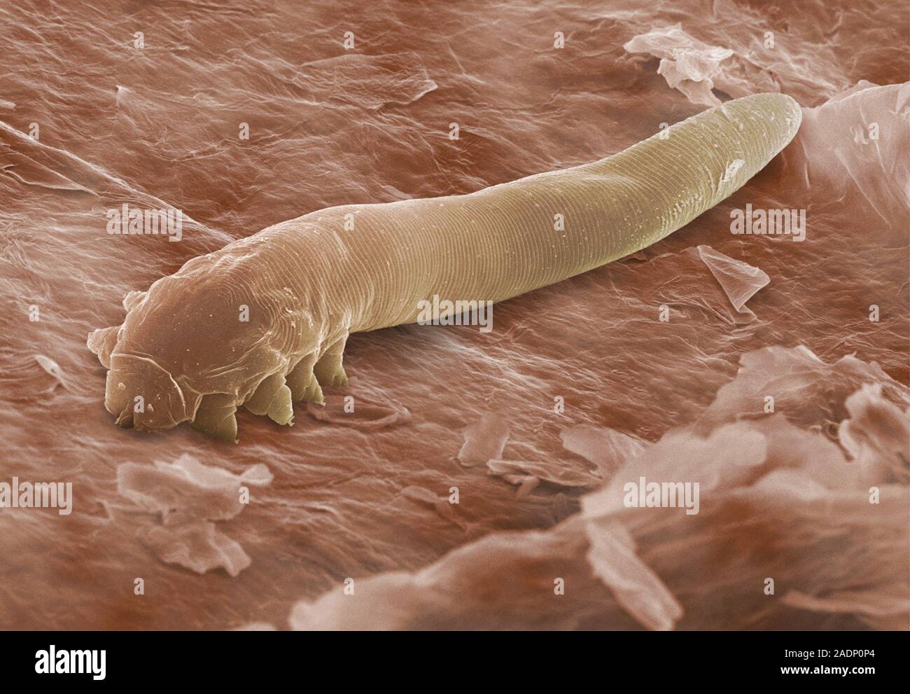 Eyelash mite. Coloured scanning electron micrograph (SEM) of an eyelash ...