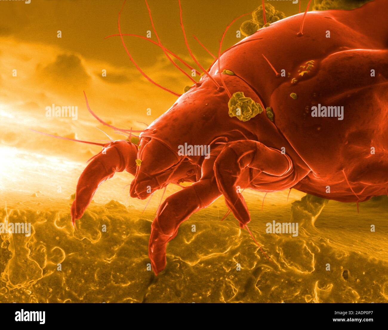 Meal mite. Coloured environmental scanning electron micrograph (ESEM ...