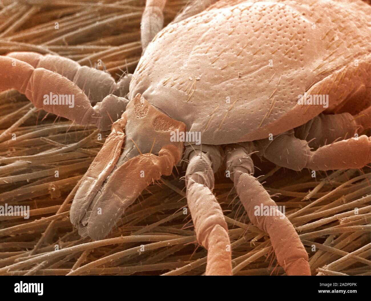 Sheep tick. Coloured scanning electron micrograph (SEM) of a sheep tick ...