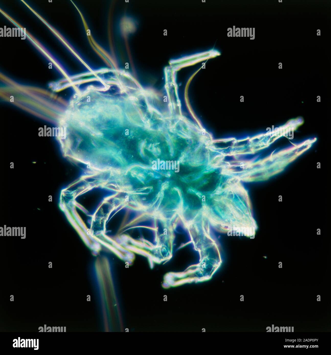 Dust mite, light micrograph. Every house contains millions of dust ...