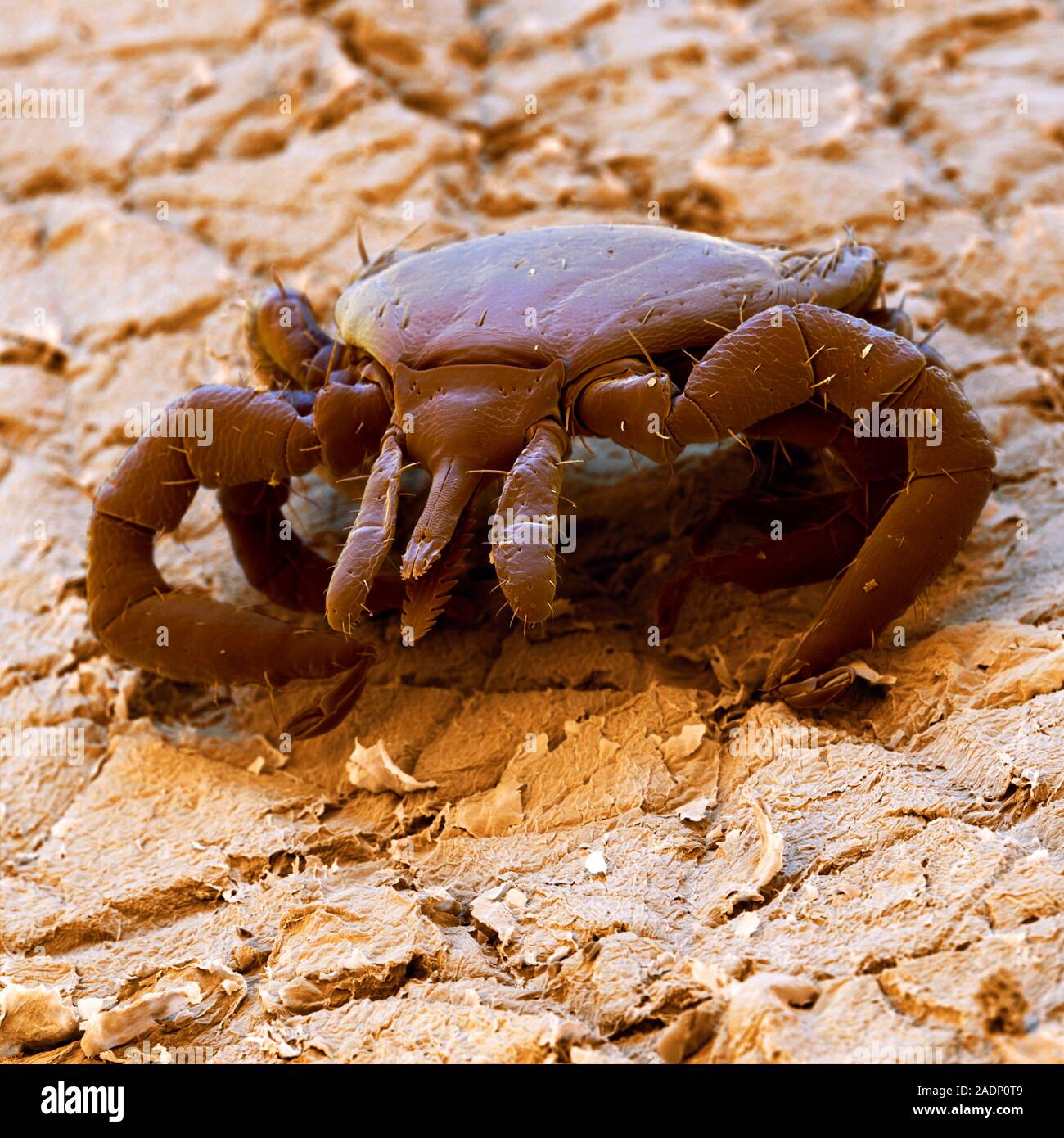 Tick. Coloured scanning electron micrograph (SEM) of a tick (family ...