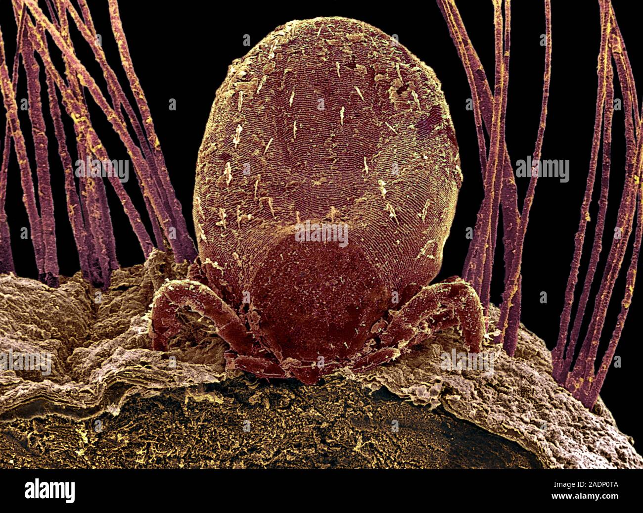 Sheep tick (Ixodes ricinus). Coloured scanning electron micrograph (SEM ...