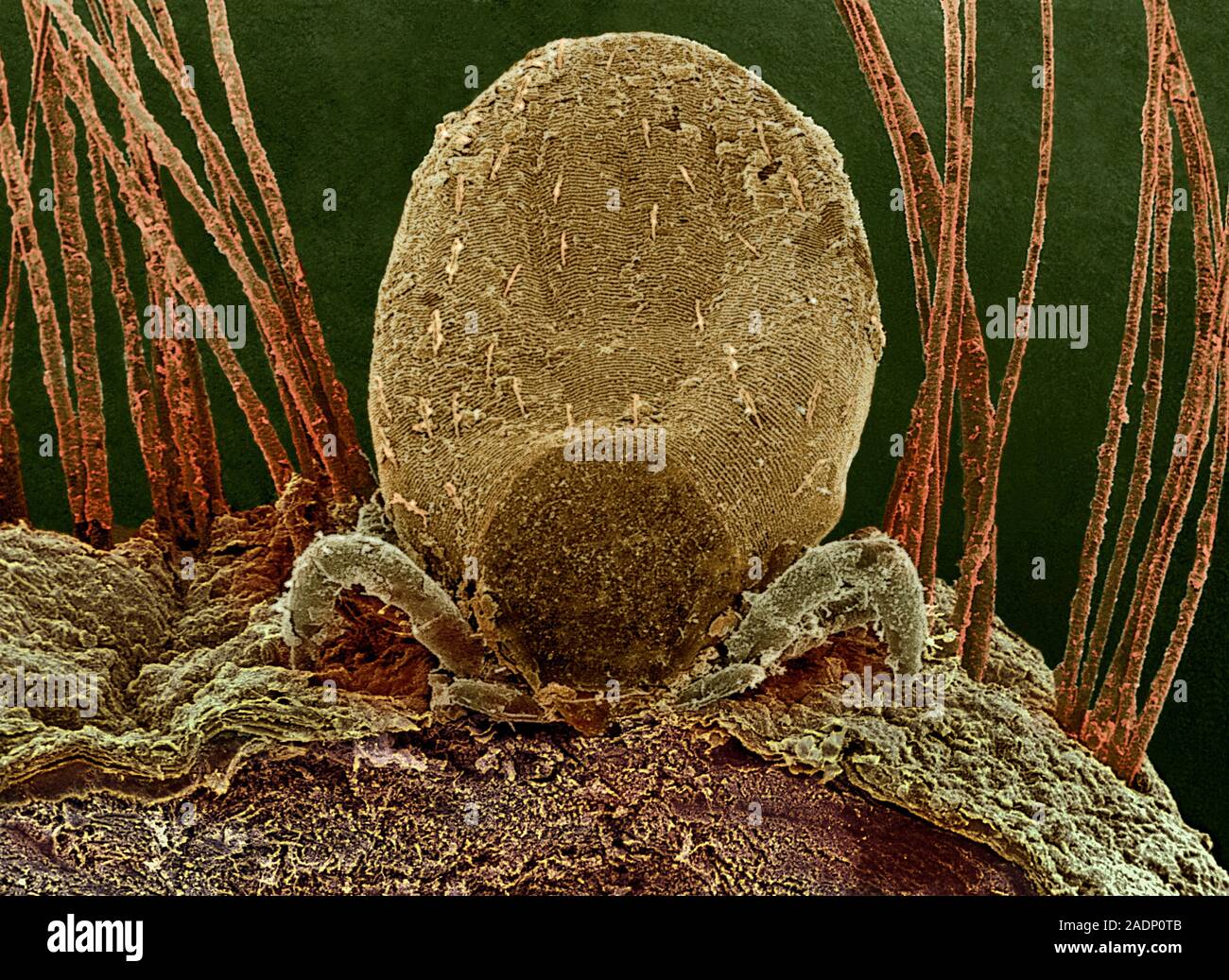 Sheep tick (Ixodes ricinus). Coloured scanning electron micrograph (SEM ...