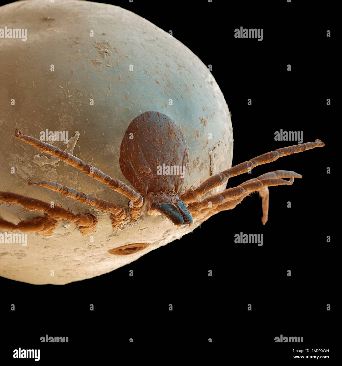 Blood-filled tick, coloured scanning electron micrograph (SEM). The ...
