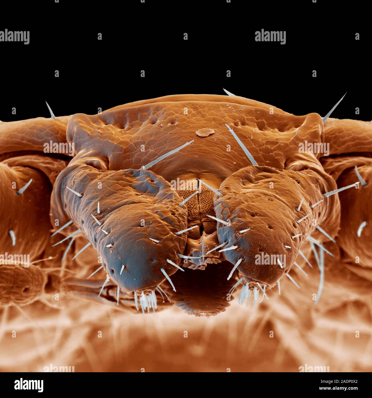 Tick mouthparts, coloured scanning electron micrograph (SEM). These ...