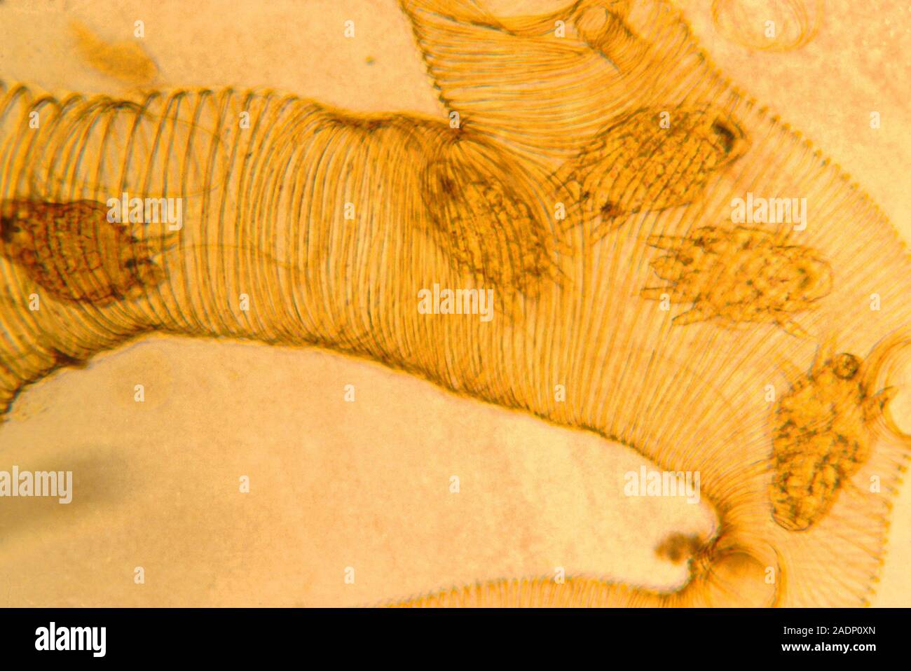 Mites in honeybee trachea, light micrograph. This trachea (airway) of a ...